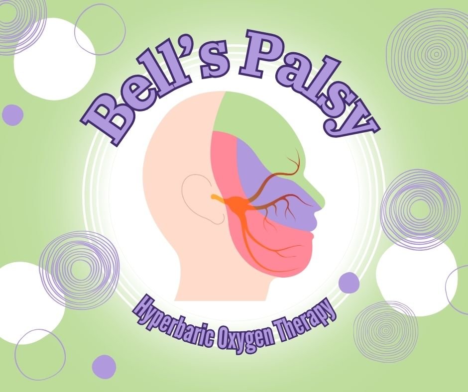 6 Ways Hyperbaric Oxygen Therapy (HBOT) treats Bell's Palsy - Dr.Darrell Kilcup